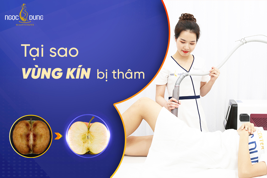 Tại Sao Vùng Kín Bị Thâm - Yaskon Beauty